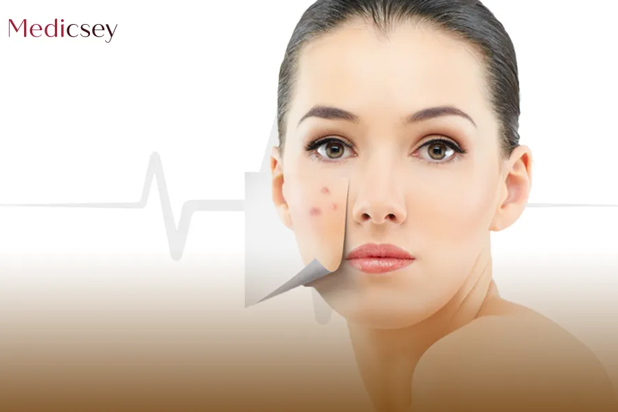 Dermatologist in istanbul Turkey | Medicsey